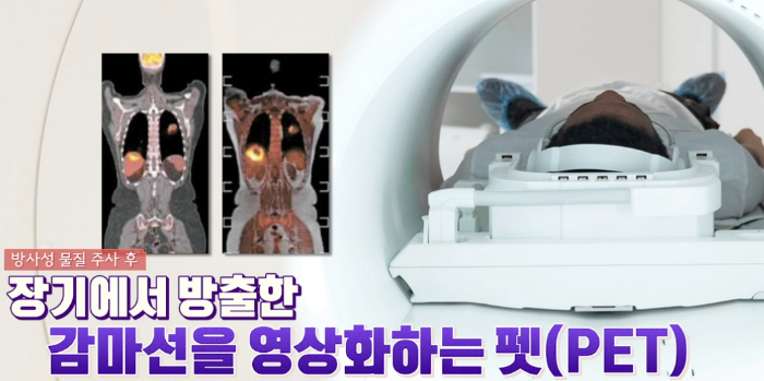 MRI, X-ray, CT , PET 검사 차이점