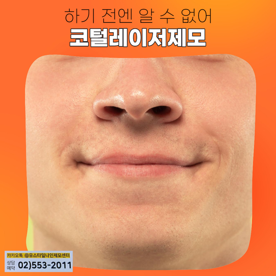 콧속털 코털레이저제모 하는 방법은