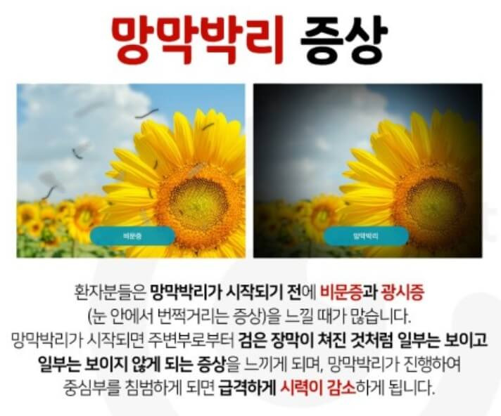 시력이 갑자기 나빠지는 이유와 시력 좋아지는 법에 대해 알아봅시다