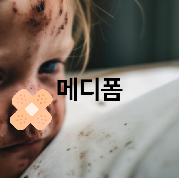 메디폼 알고 보면 플라스틱이다 올바른 사용법 교체시기