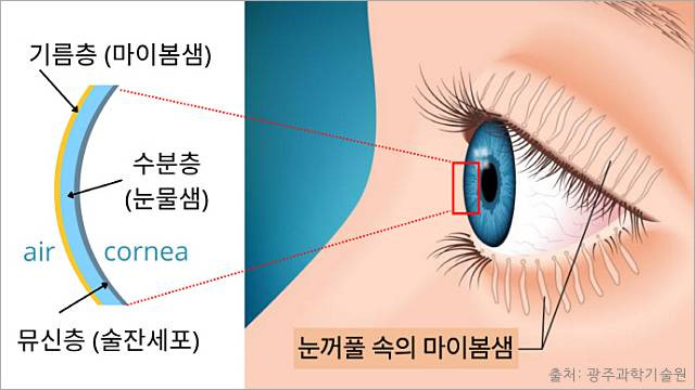 눈 따갑고 눈물 안구건조증 해결 이렇게 하세요 눈뻑뻑함 이물감 눈건조증 원인