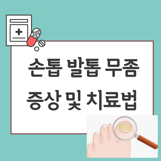 손톱 발톱 무좀 치료법 약 추천