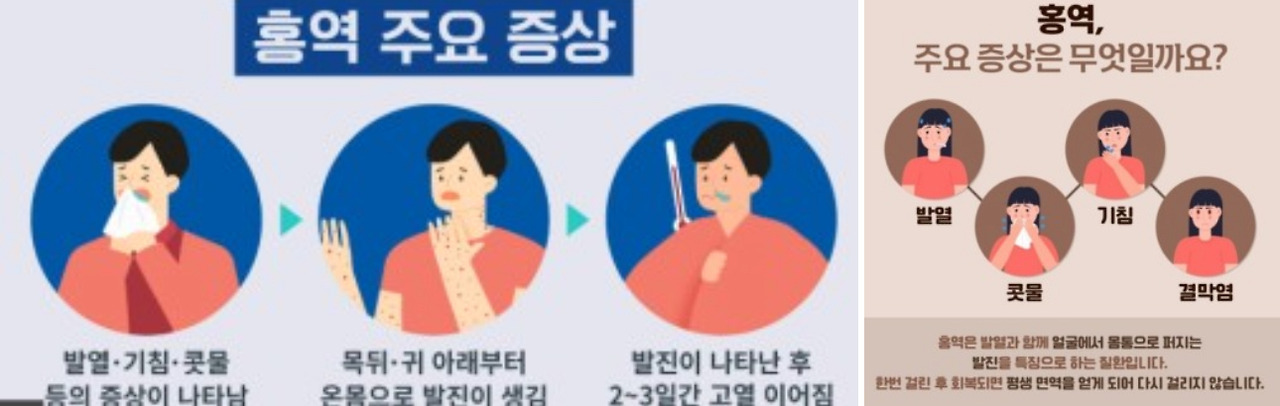 홍역 예방접종부터 증상 수두와 차이점까지 뜻 영어 표현 검사 주사 발진 완벽 정리