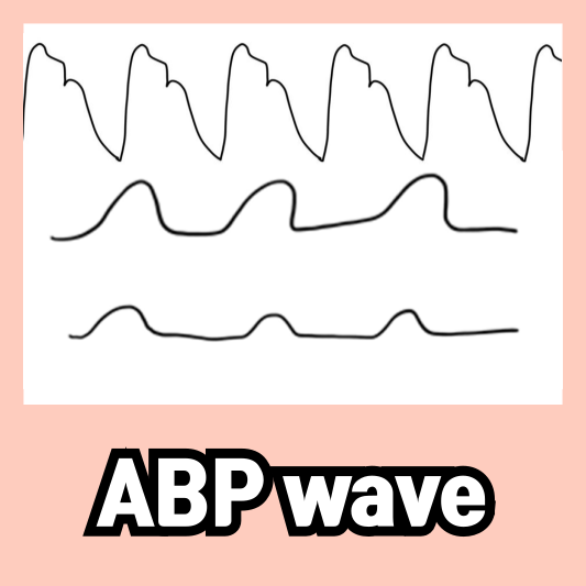 Aterial line monitoring ABP wave 해석법