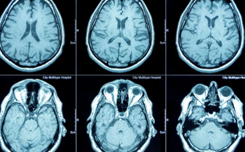 MRI 검사 비용 정리!