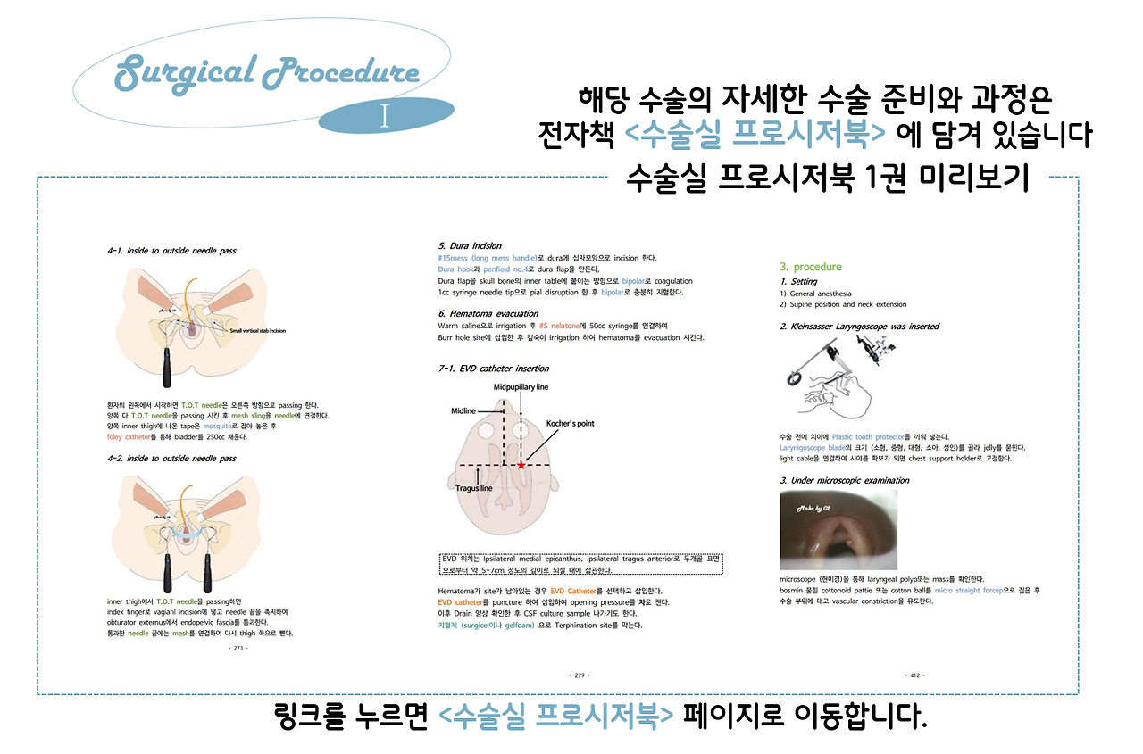 URO / TUR-B, TUR-P (Transurethralresection bladder, Prostate) 경요도 방광 ...