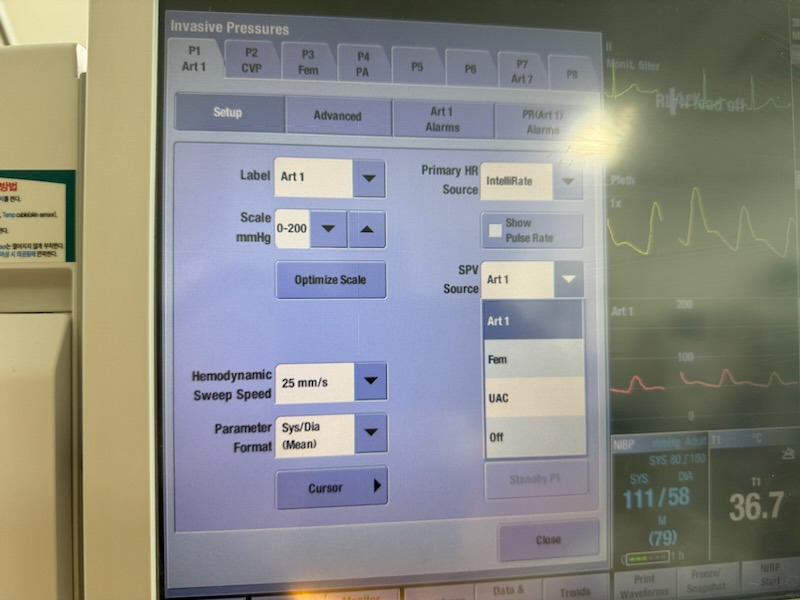 PPV(Pulse Pressure Variation): A-line을 통한 수액 반응성 평가