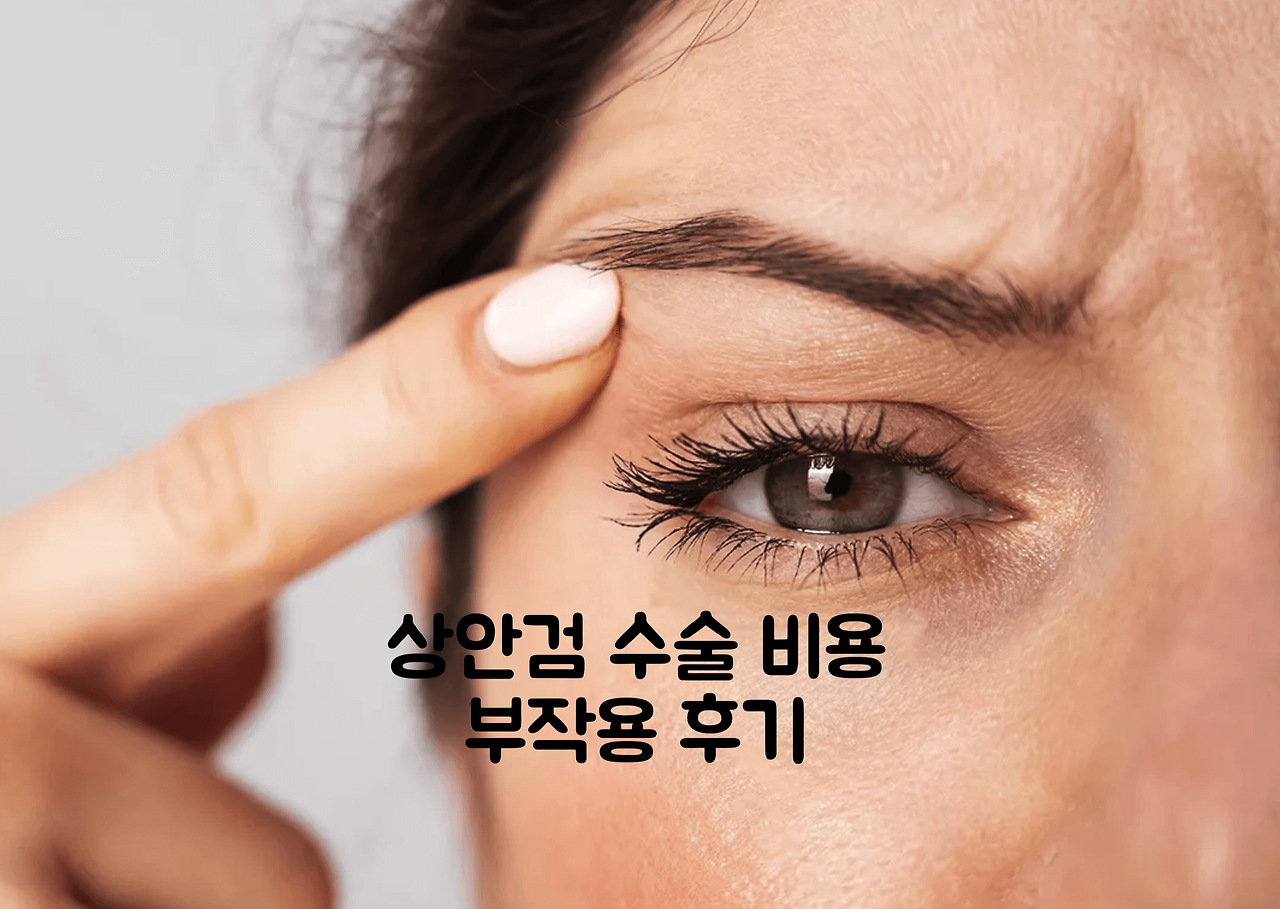 상안검 수술 비용 부작용 후기