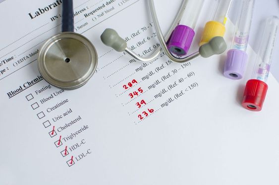 Lipid 검사지질검사 총콜레스테롤ldlhdltg중성지방 정상수치 콜레스테롤검사검사 방법