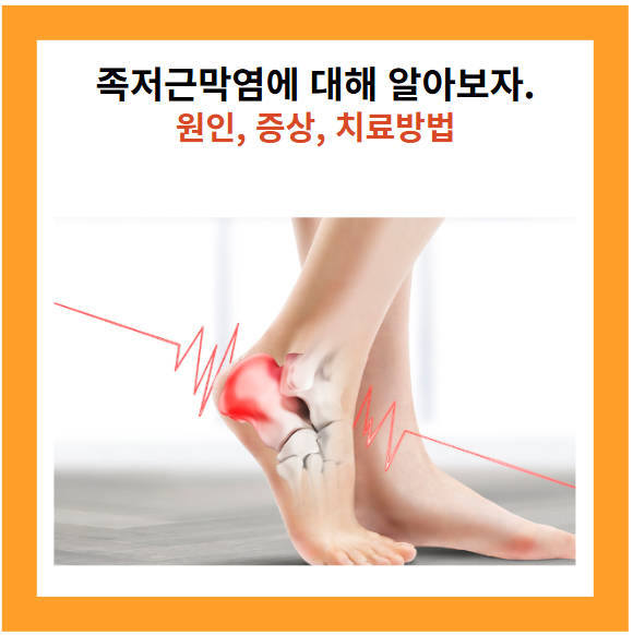 족막근저염 근저족막염 족저근막염 원인 증상 치료 방법