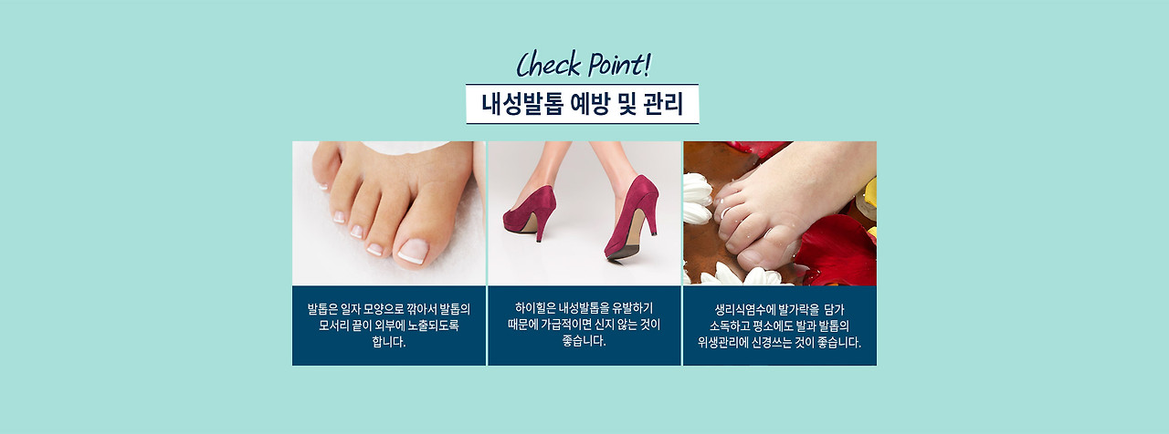 내성발톱 자가치료 방법 총정리