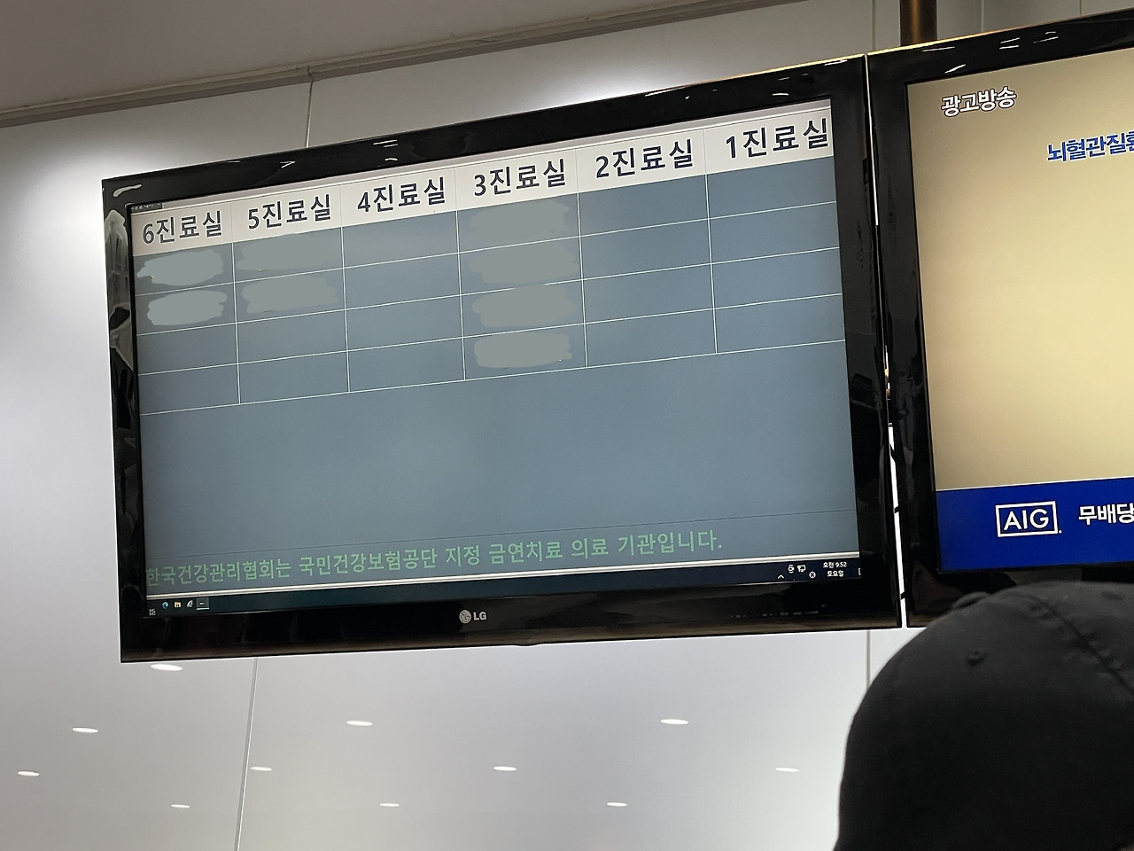 B형간염 예방접종 2차 완료 가격통증 후기