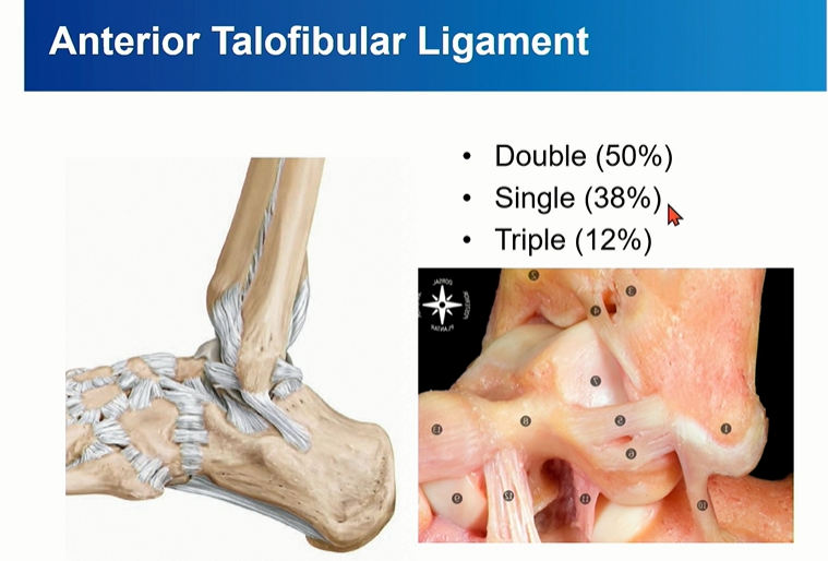 발목 MRI 공부_Ankle ligaments