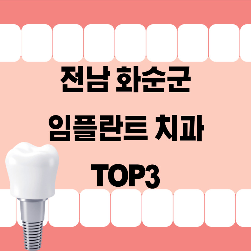 전남 화순군 임플란트 치과 잘하는곳 추천 Top3 가격 저렴한곳 비용 싼곳 유명한곳