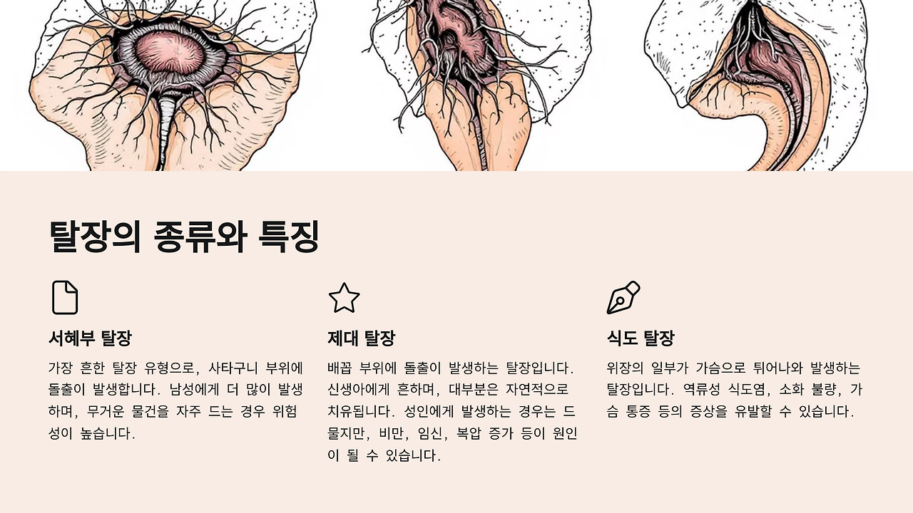 탈장 증상과 원인 치료 방법 알아야 할 5가지 사실