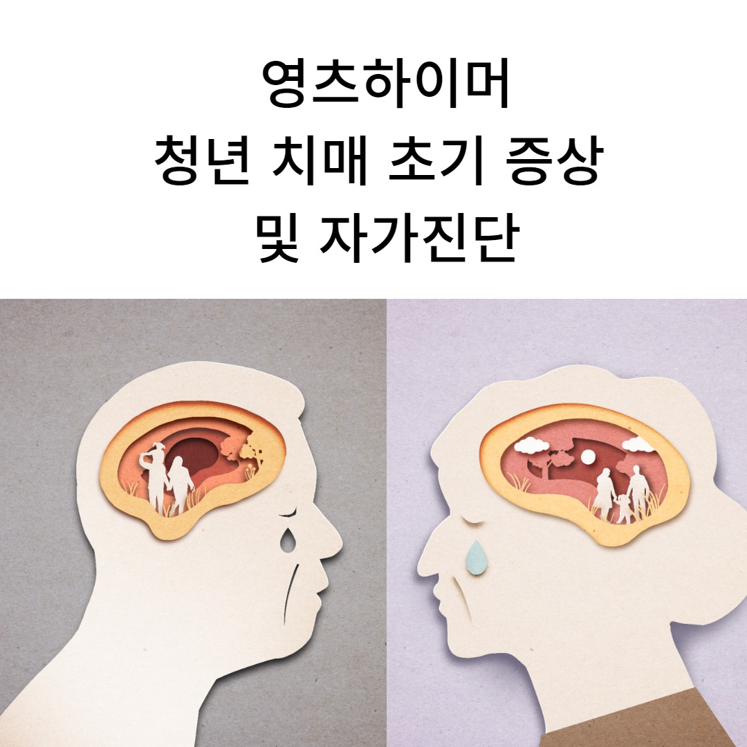 알츠하이머 청년 치매 초기 증상 의심 증상 및 자가진단