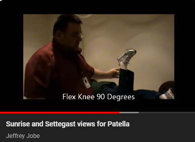 일반촬영 x-ray 엑스레이 슬개골, 무릎사진 (knee Series) - Knee joint axial view(patella ...