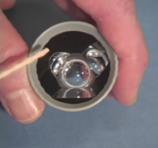 아르곤 레이저 섬유주 성형술(Argon Laser Trabeculoplasty, ALT) 원리, 기전, 치료방법