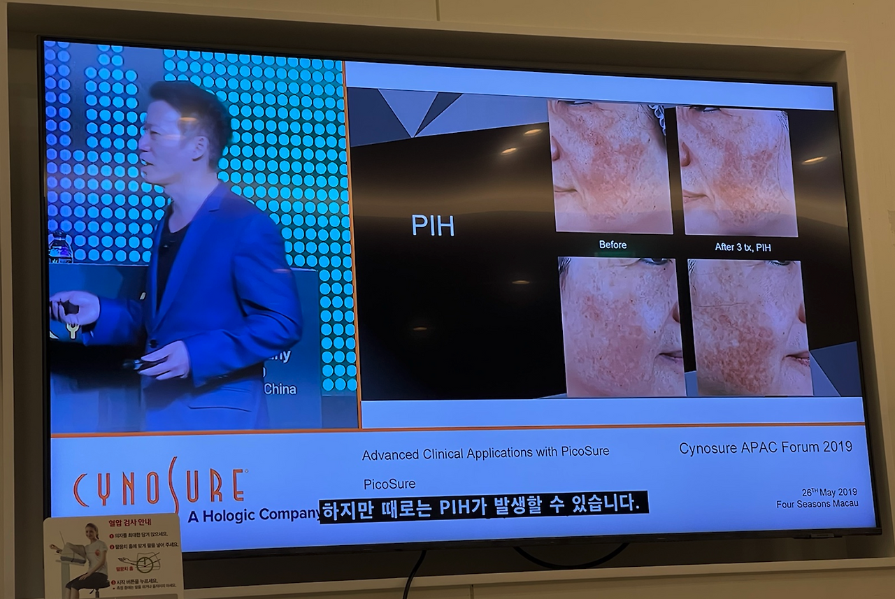 내 얼굴은 전쟁터 생전 처음으로 얼굴에 레이저를 쏴보다 일광흑자 클라리티레이저