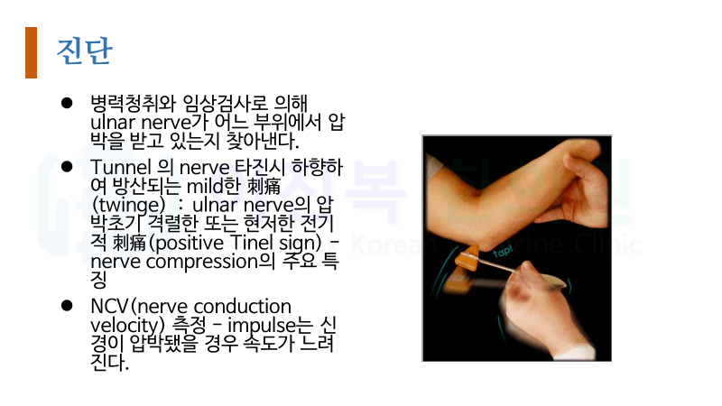 전주 이진복한의원 주관 증후군척골 신경 포착