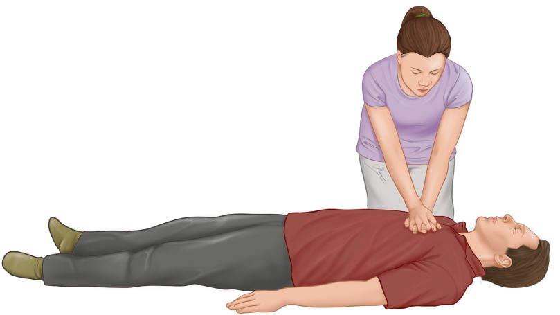 심폐소생술 Cpr 순서 · 하는방법 메인닷컴