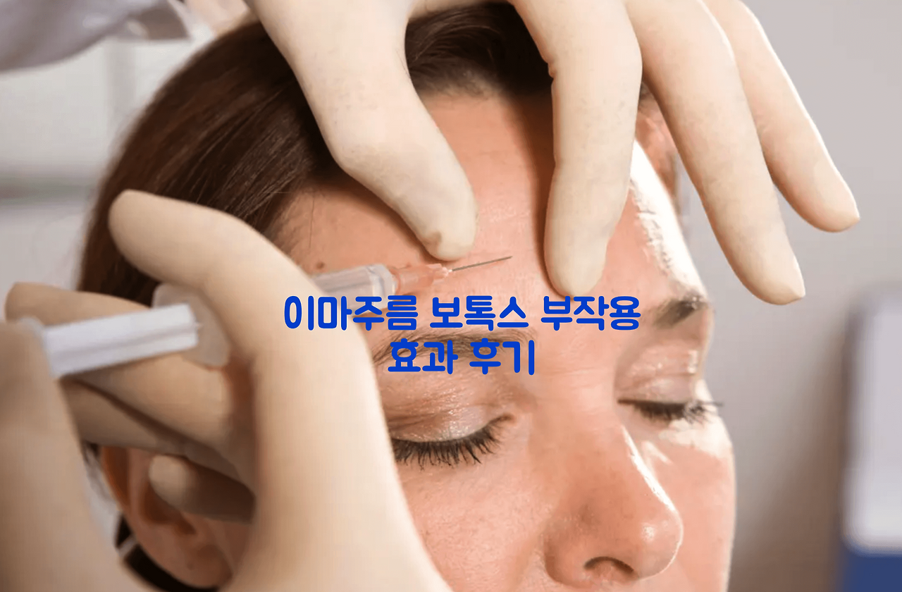 이마주름 보톡스 부작용 효과 후기
