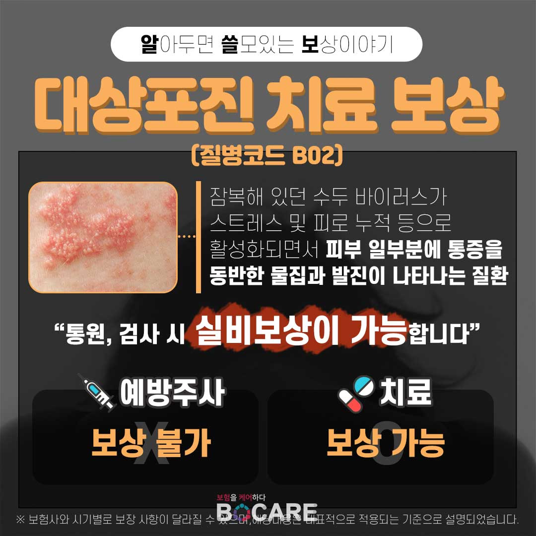 대상포진의 증상 및 원인 실비 치료보상