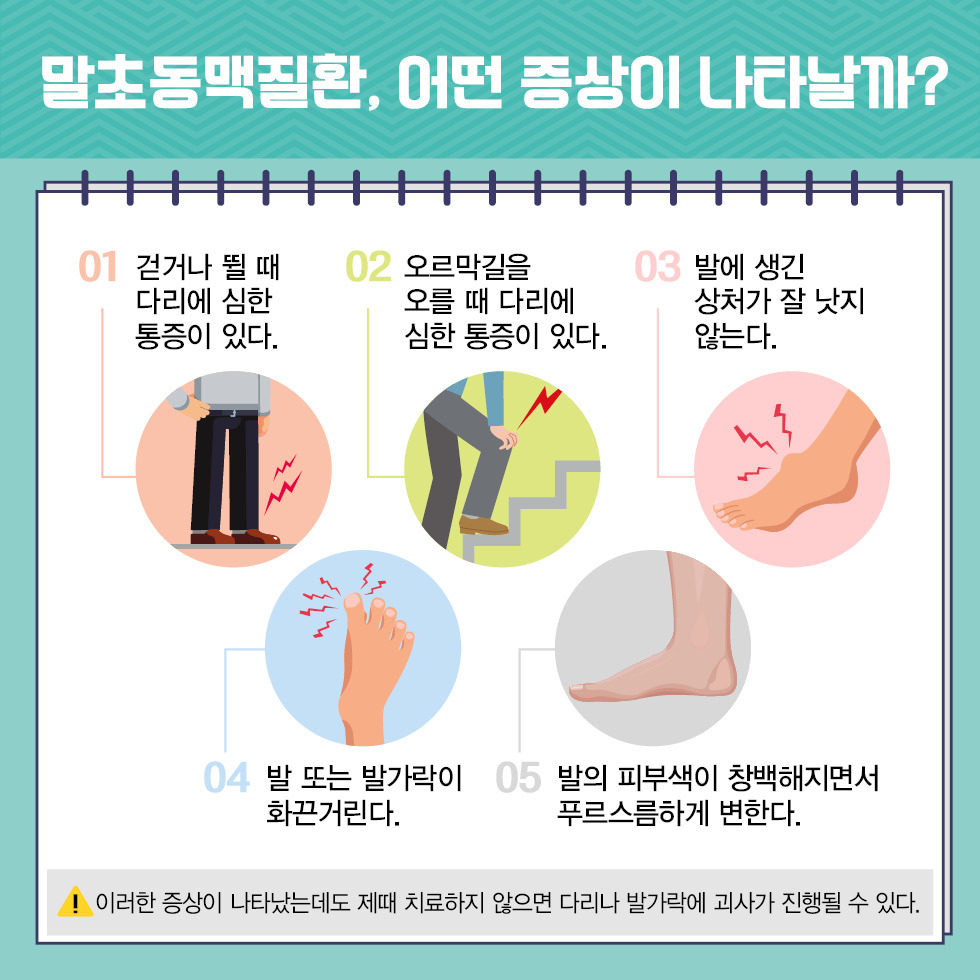 혈관 막혀 다리 절단까지 부르는 말초동맥질환