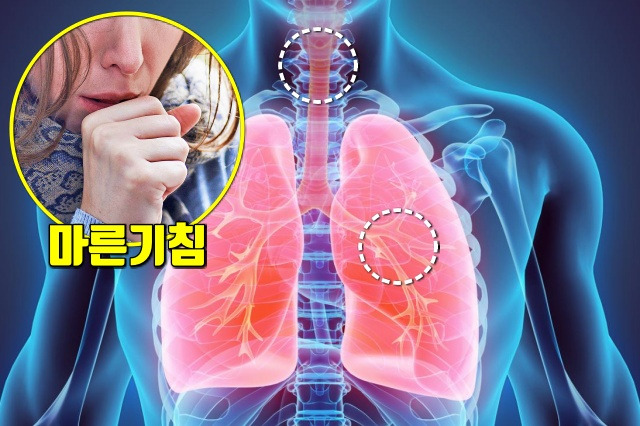 가습기 적정 실내습도로 틀면 벌어지는 일 7 가습기 효능 효과 7가지