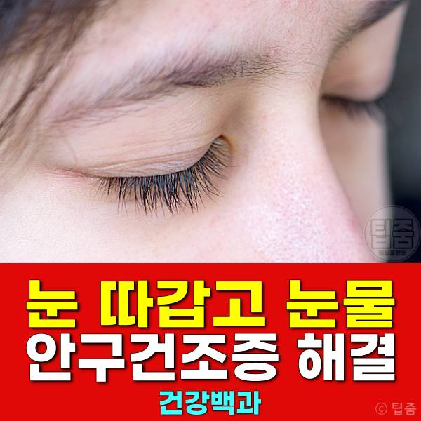 눈 따갑고 눈물 안구건조증 해결 이렇게 하세요 눈뻑뻑함 이물감 눈건조증 원인