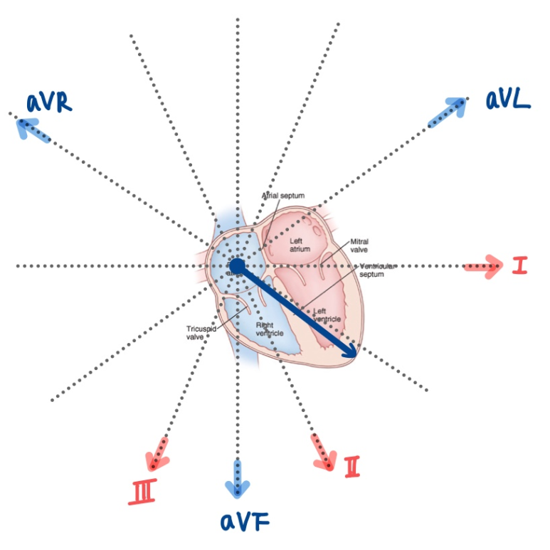 Ecg 기초정리 1 심전도 기초설명 심전도의 원리 사지유도 정상심전도