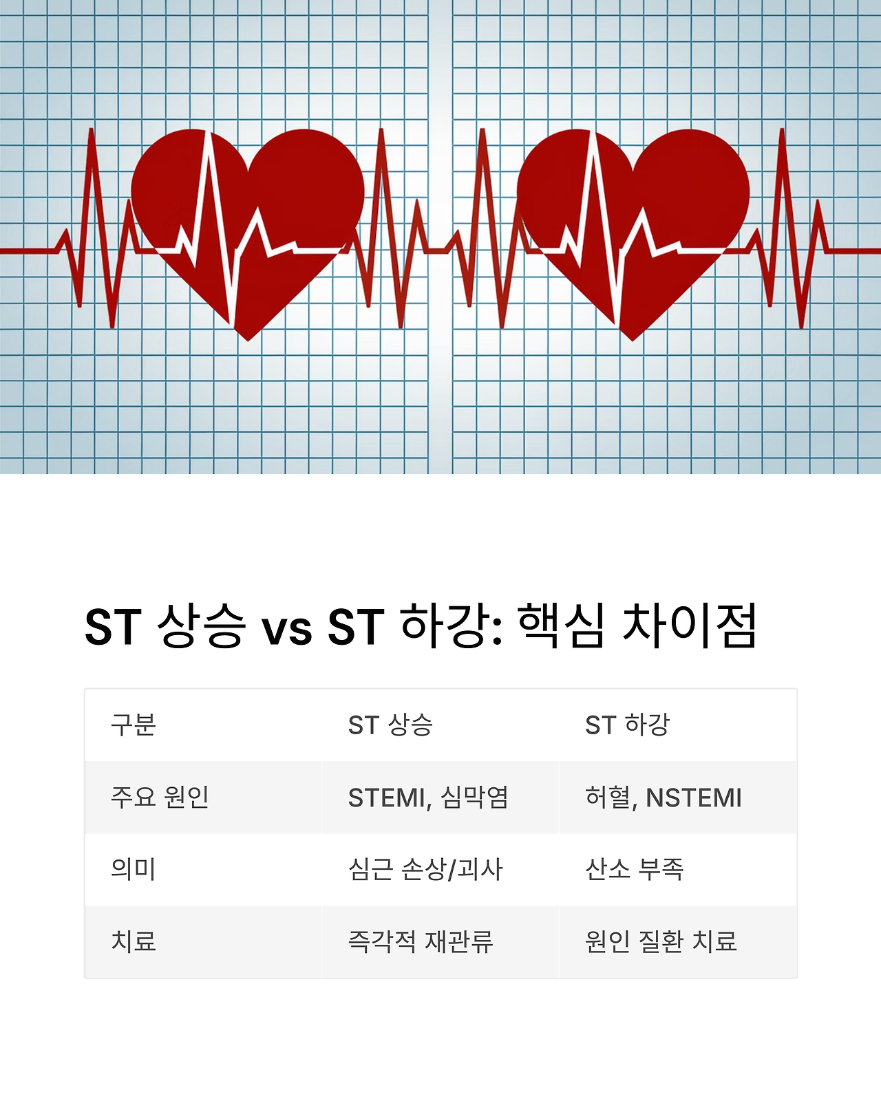 심전도 이상 신호 St 분절 상승하강과 T파 역전 임상 경험으로 파헤치는 심장 건강 이야기