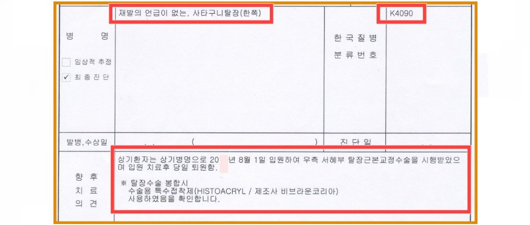 탈장 수술 후기 서혜부 무인공망
