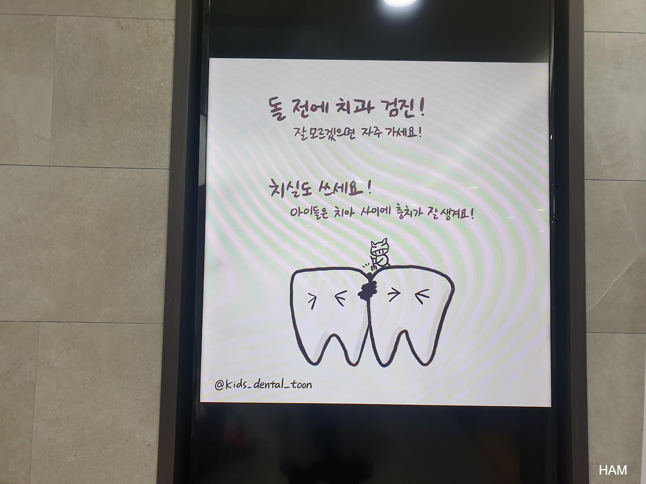 영유아 구강검진 시기 웃음가스로 충치치료 완료