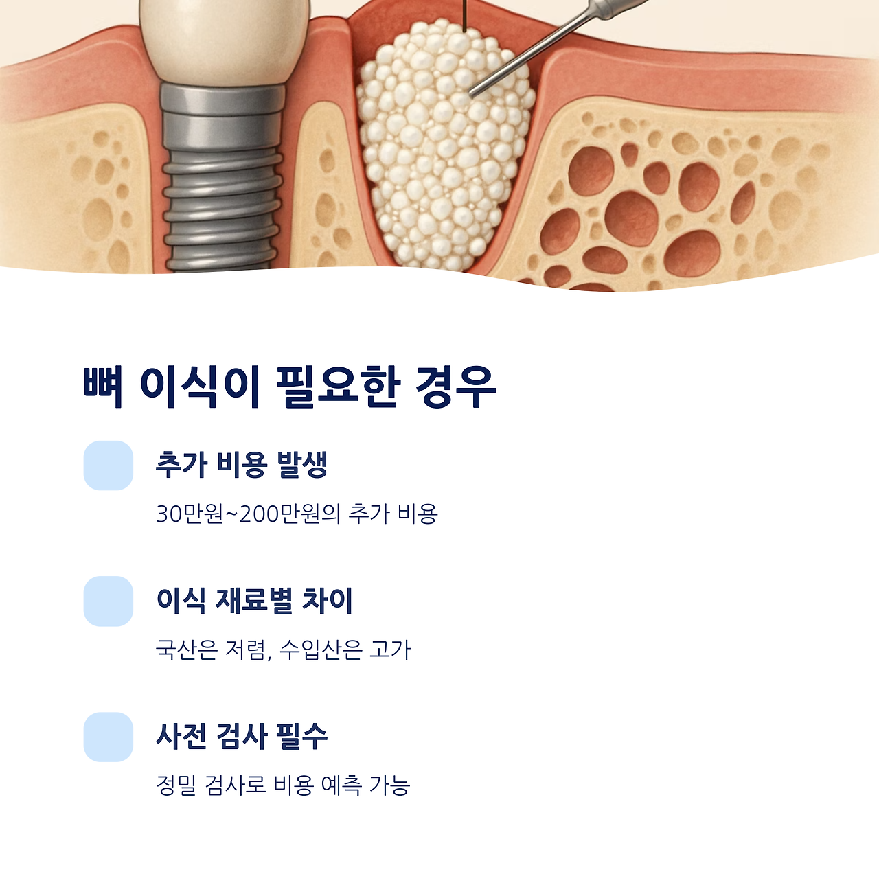 2025년 임플란트 비용 치과 마다 다르죠 끝내드려요 최신 가격 정리
