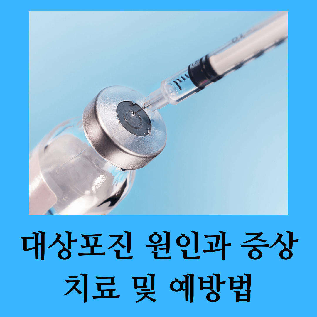 대상포진 원인과 증상 치료 및 예방법