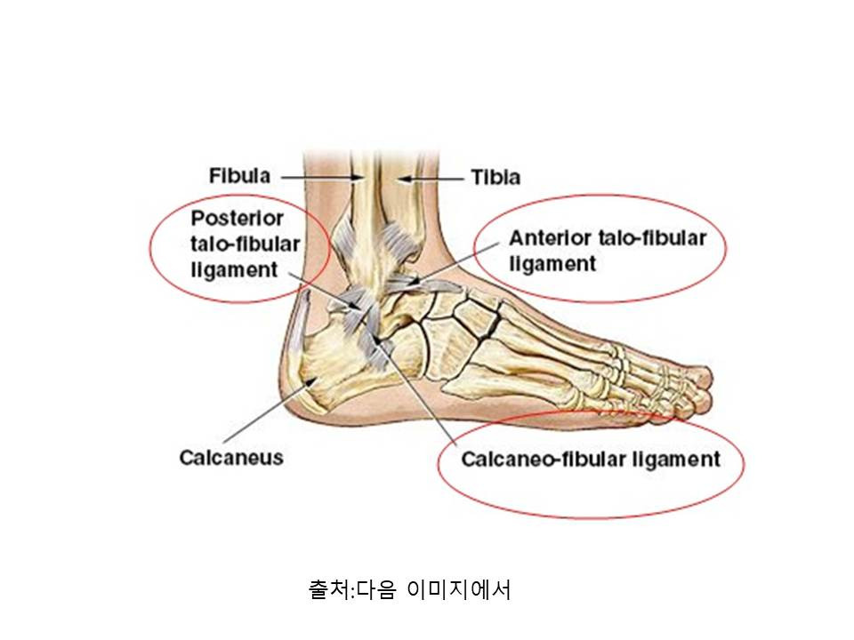 크로바한의원 발목 인대가 늘어난 후 자주 삐어요발목염좌전거비인대염좌대전둔산동한의원