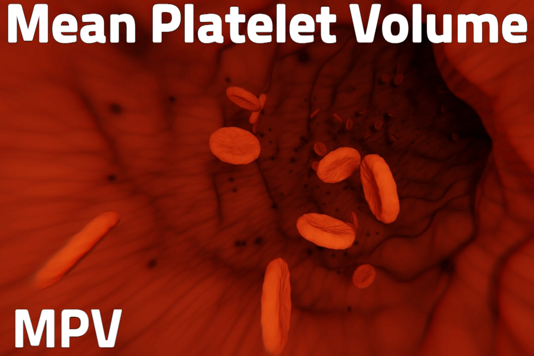 혈소판 용적: MPV(Mean Platelet Volume)