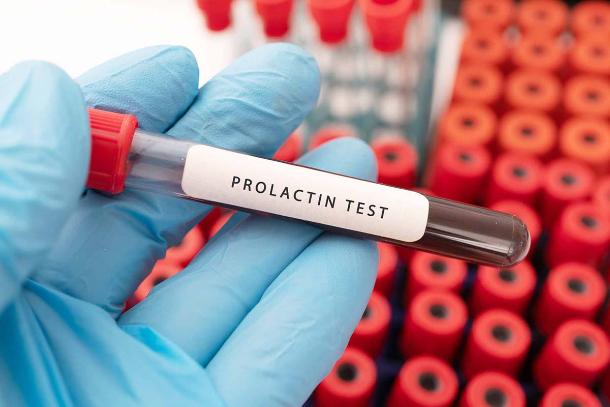 Prolactin프로락틴검사 프로락틴검사방법프로락틴검사결과프로락틴정상수치고프로락틴혈증불임난임무월경