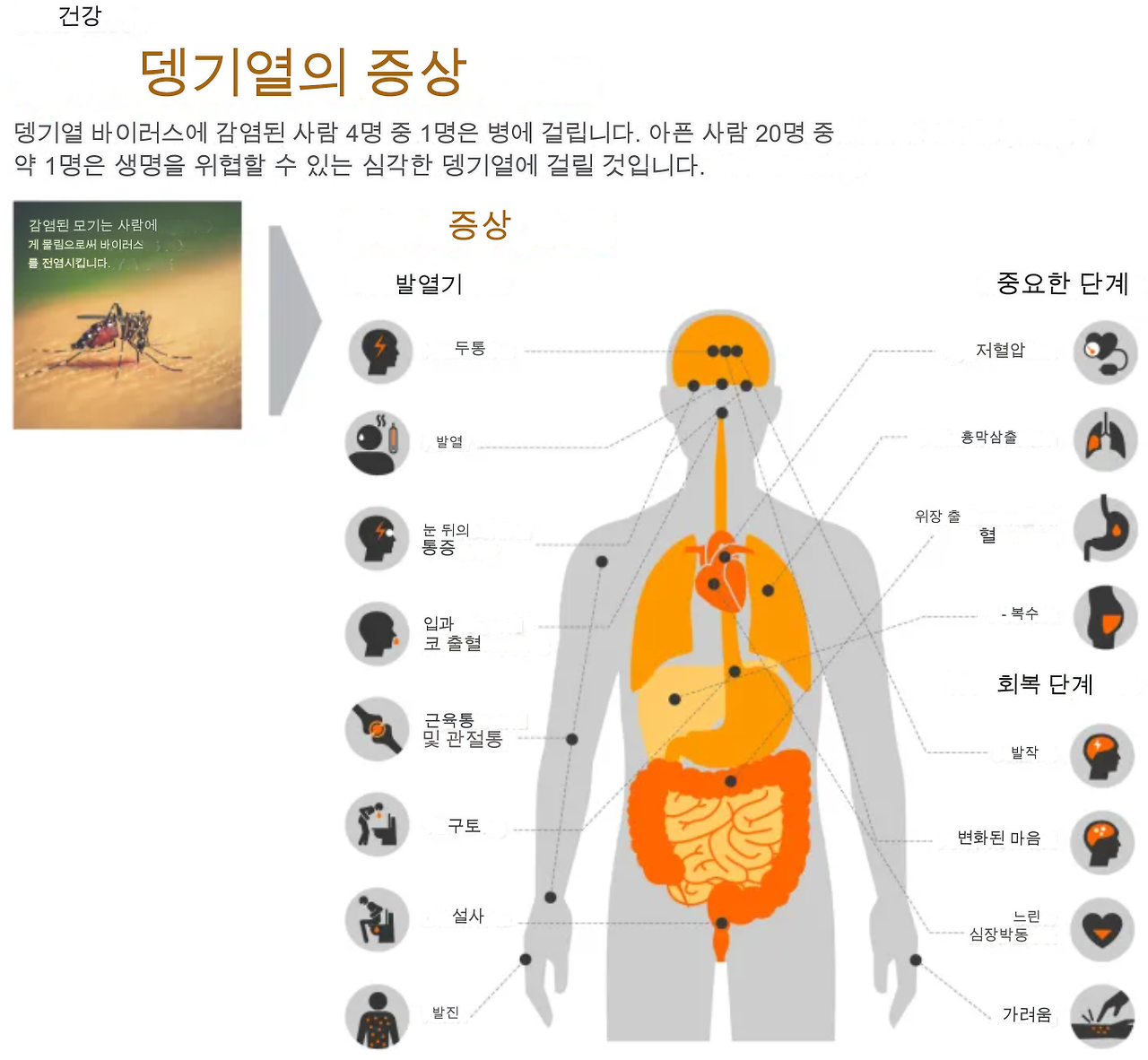 속보 방글라데시 1000명 이상의 사망자를 낸 전례 없는 뎅기열 발병에 맞서 싸우다
