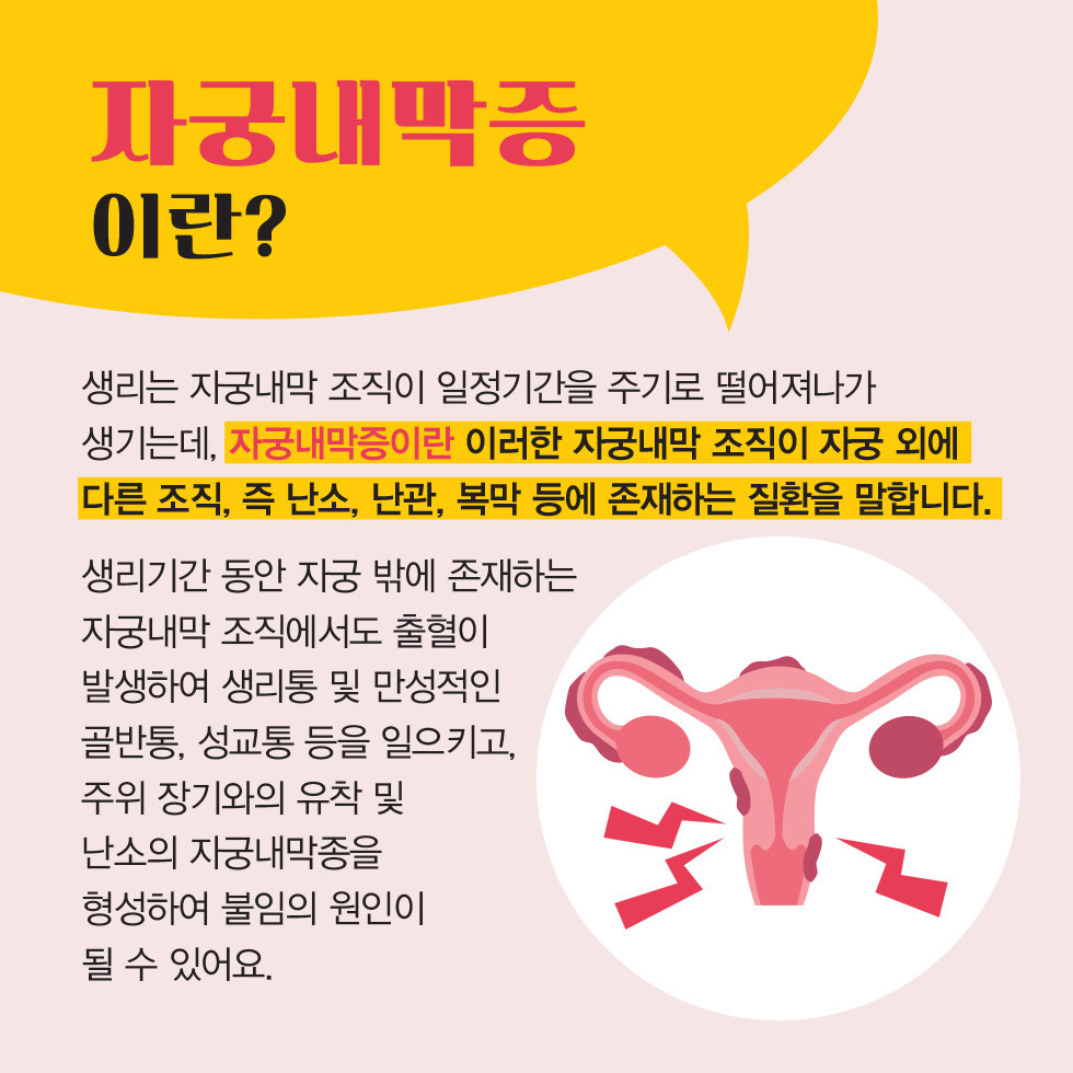 자궁내막증식증 원인부터 수술 방법 회복 기간 방치시 위험까지