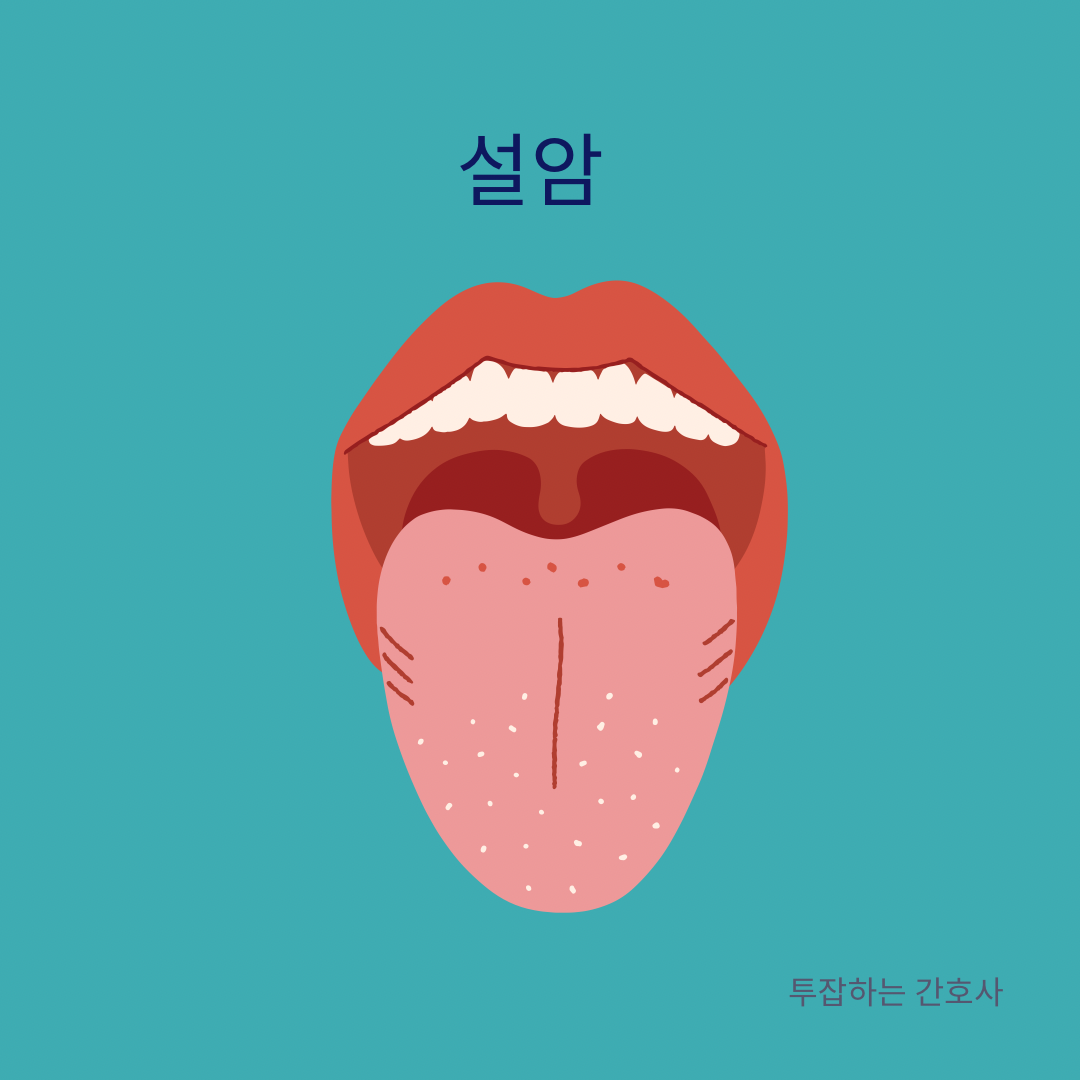 설암 초기증상 설암 3기 라고 예방 진단 투잡하는 간호사