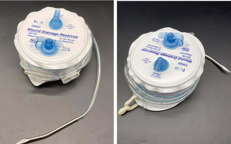 수술실스크럽 기본 - 배액관 종류 Drain- HemoVac, SS100L /SS100L+/ SS100JP drainage