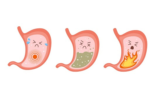 소화불량 소화가 안되면 살이 더 찔까 소화 잘되는 사람 다이어트 진실