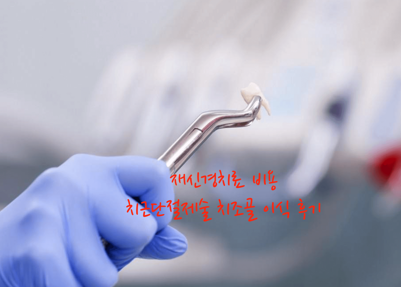 재신경치료 비용 치근단절제술 치조골이식 후기