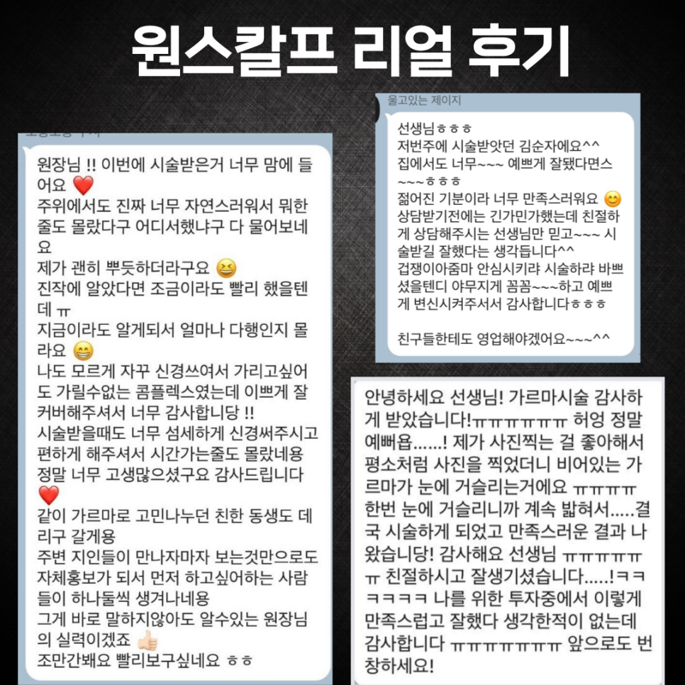 부산 정수리 두피문신 솔직한 후기