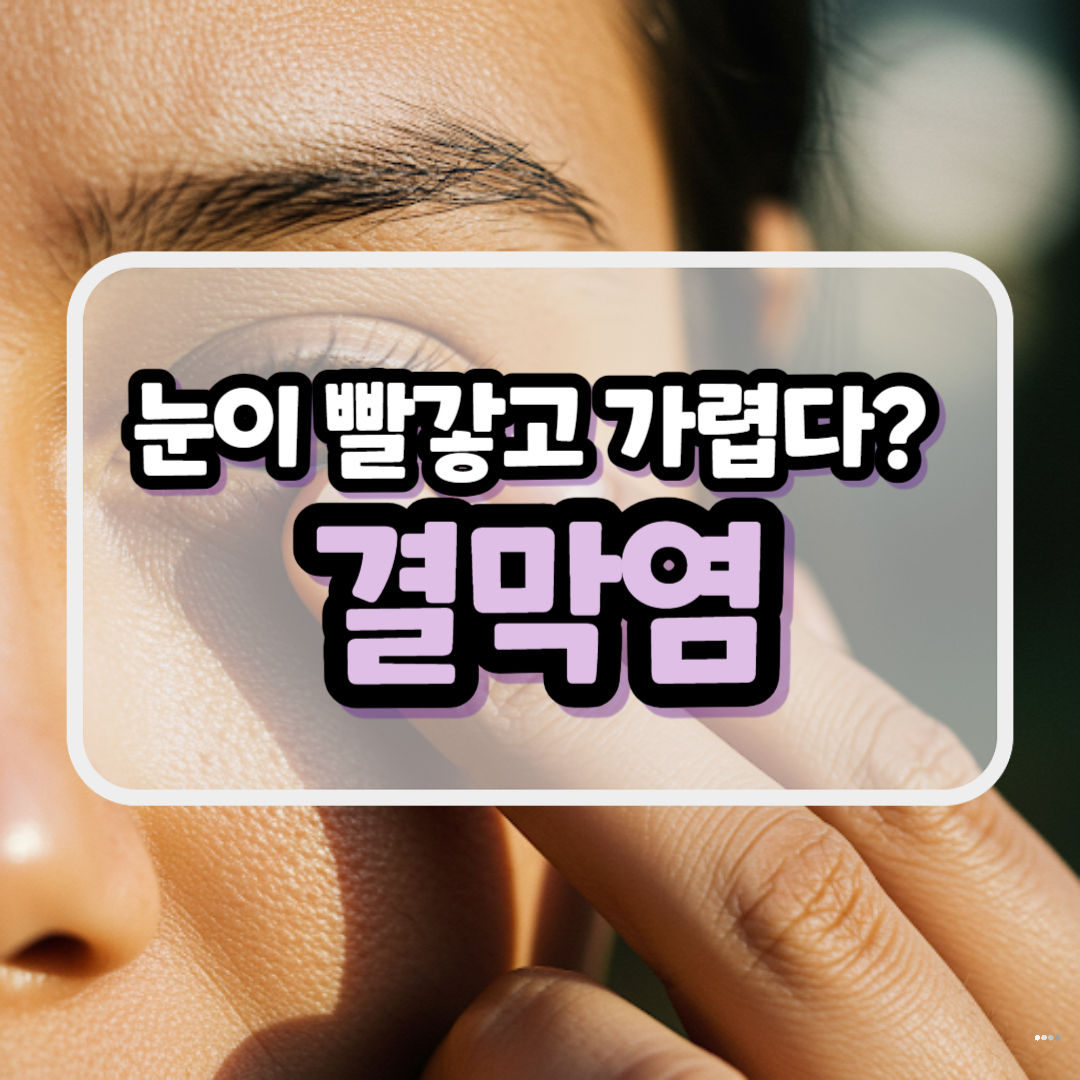 결막염 증상 원인 치료기간 전염 치료 방법으로 벗어나기