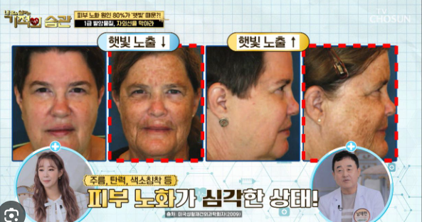 Ebs명의 김범준 교수 프로필 진료예약 피부과 명의 김범준 교수 서울인포스트