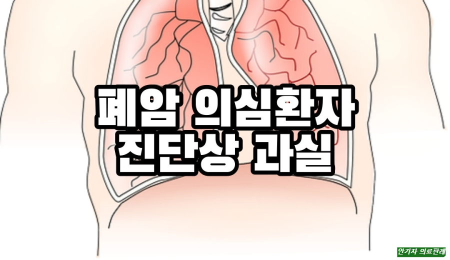폐결절 커진 폐암 의심 환자 조직검사 안한 과실