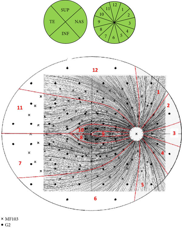 녹내장 망막신경섬유층 RNFL, Retinal nerve fiber layer 구조 대사, 손상